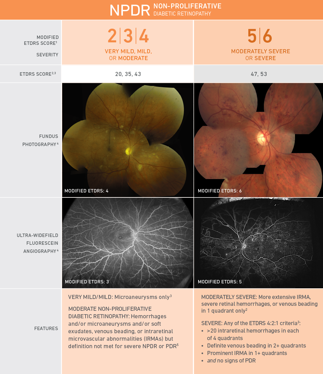 LUCENTIS® (ranibizumab) Mechanism of Action (MoA) for DR & DME